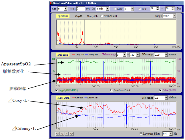 OEG-SpO2 計測例 | スペクトラテック