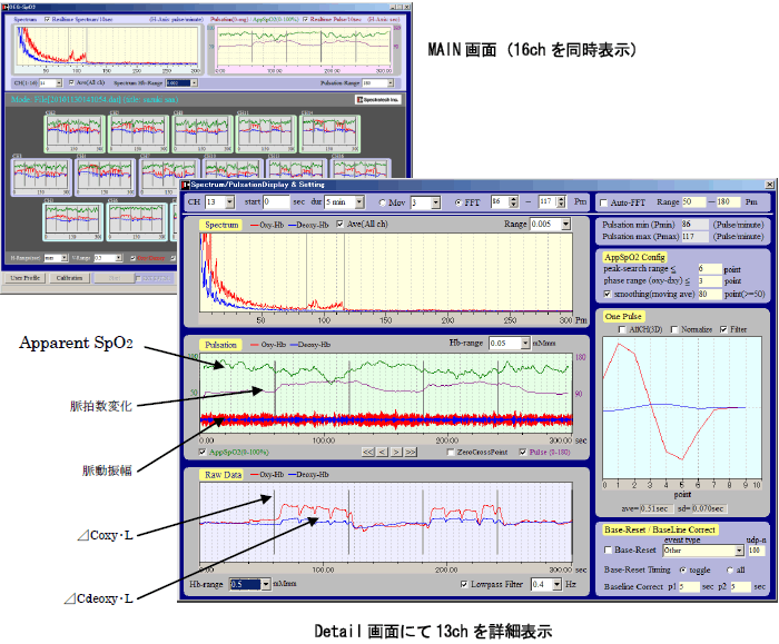 OEG-SpO2 計測例 | スペクトラテック